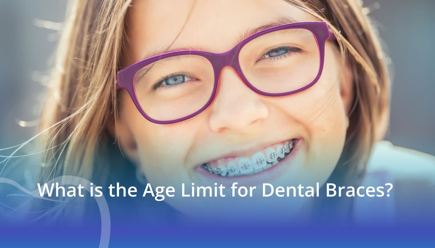 What is the Age Limit for Dental Braces?